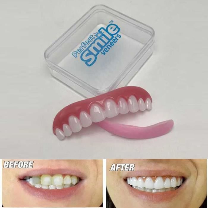 Perfect Smile Instant Smile Comfort Fit Flex Teeth Top Silicone Placage ...
